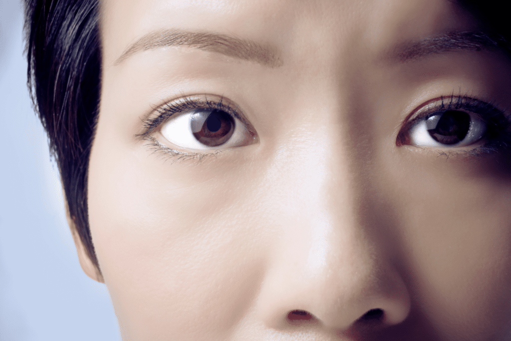 Fotona SmoothEye™ Non-Surgical Laser Eye Bag Removal - SL Aesthetic Clinic