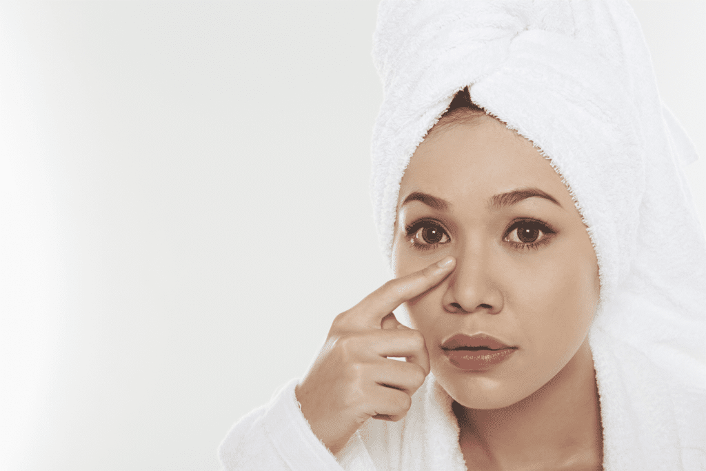 All You Need To Know About Nose Threadlift in Singapore | SL Aesthetic