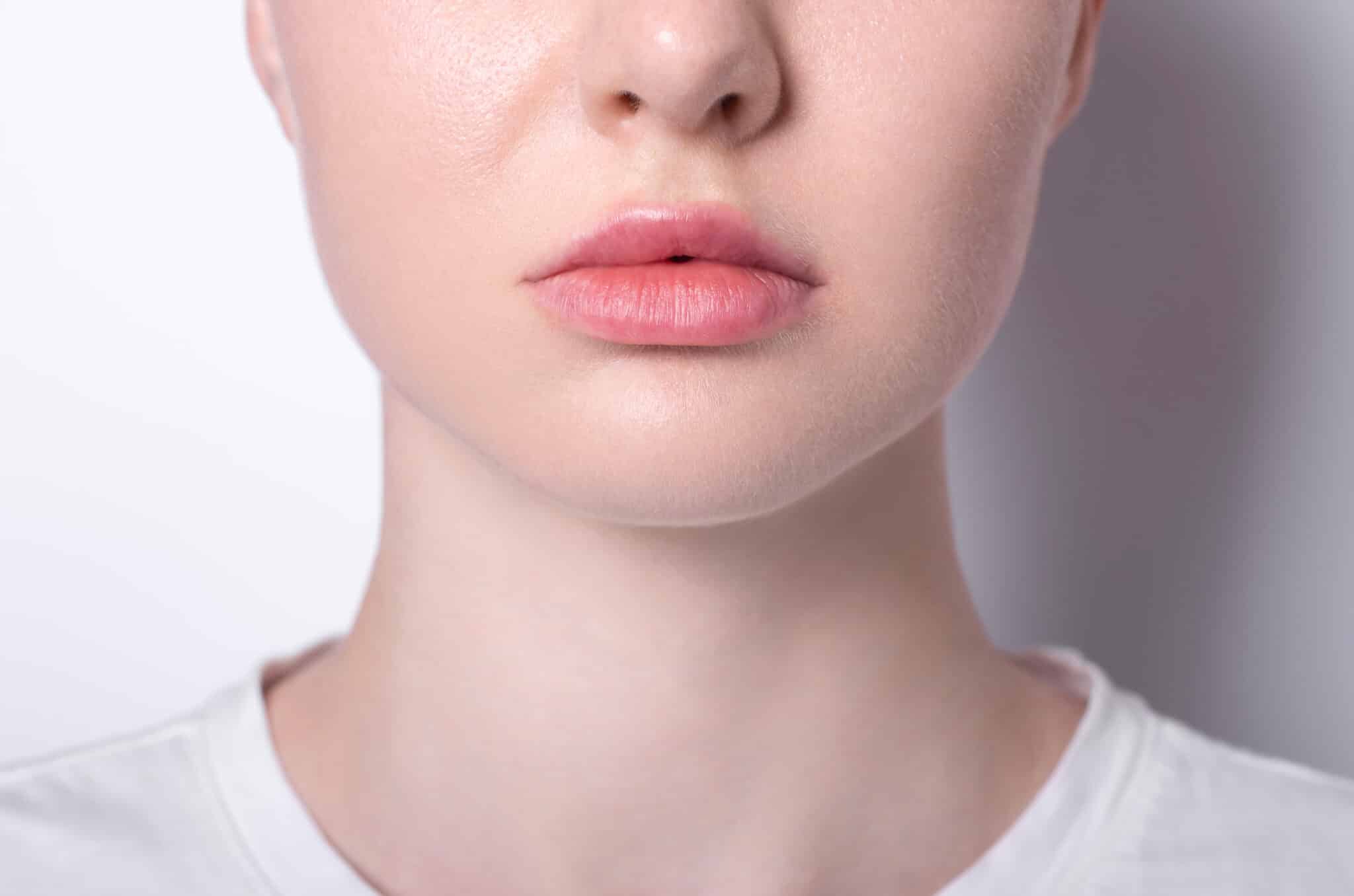 6 Common Lip Conditions and How Lip Fillers Can Treat Them - SL ...