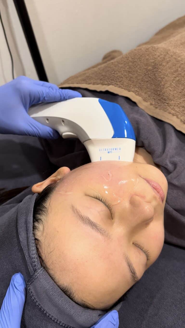 Ultraformer MPT | New HIFU Face & Body Lifting in Singapore