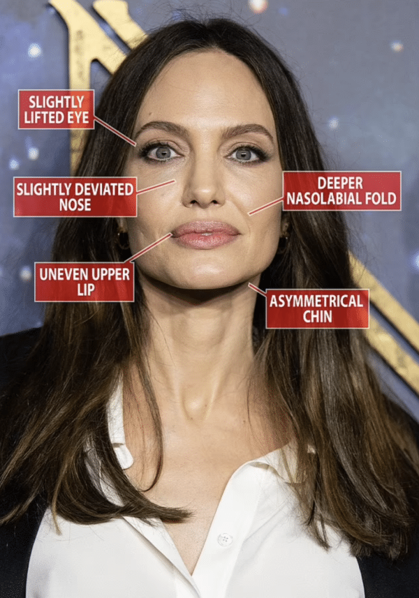 What No One Tells You About Facial Asymmetry (And How To Fix It)