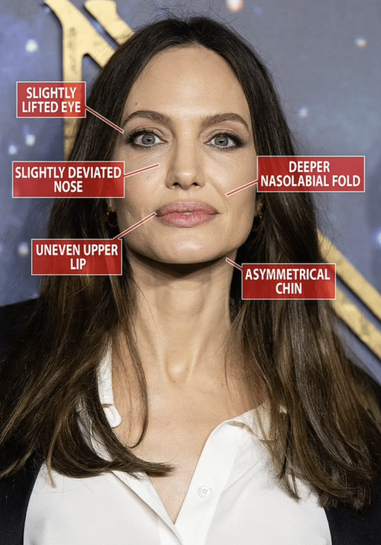 What No One Tells You About Facial Asymmetry (And How To Fix It)